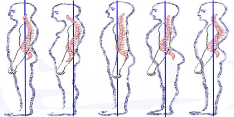 Improve brain function and chronic pain through posture – Natural ...